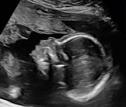 Decima poem debut | lit bits and pieces